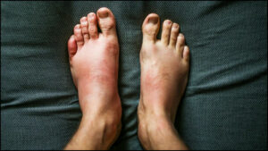 How to Tell if You have Wide Feet [Know Your Actual Size]